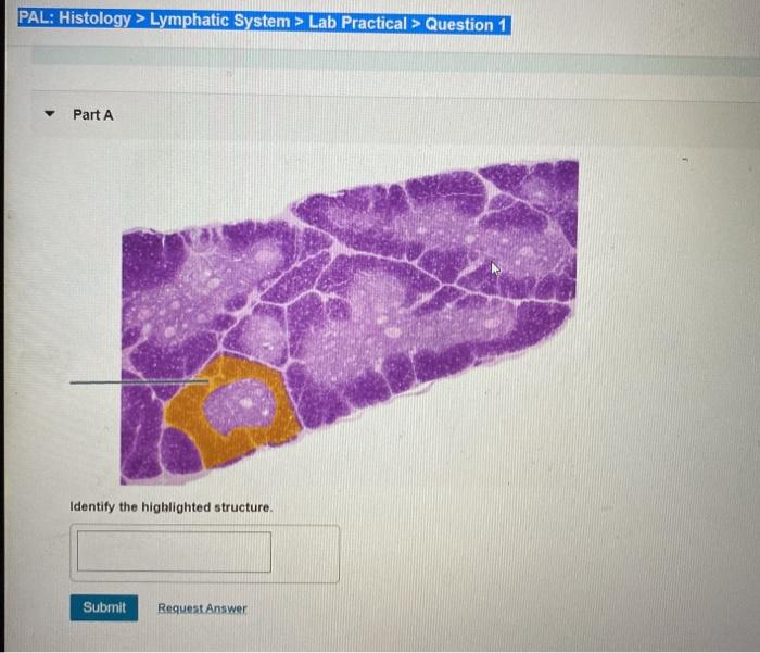 Solved PAL: Histology > Lymphatic System > Lab Practical > | Chegg.com