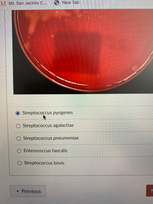 Blood Agar Streptococcus Pyogenes