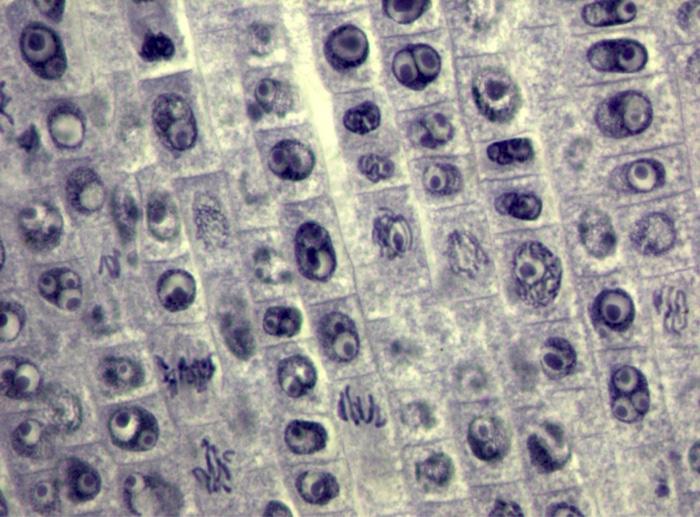 Solved count the number of cells in each of the cell phases, | Chegg.com