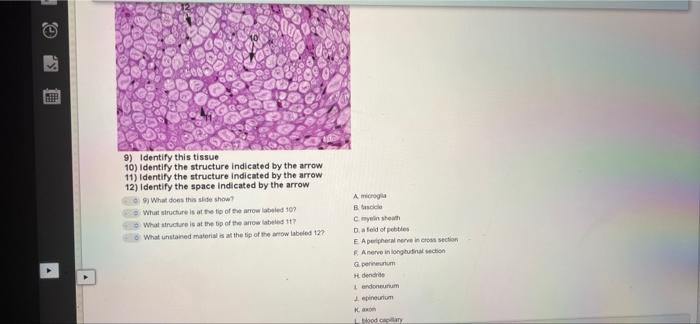 Solved 9) Identify this tissue 10) identify the structure | Chegg.com
