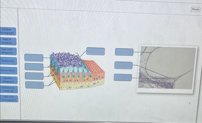 Solved Otoliths micrograph) Wall of vestibule Hair cells | Chegg.com