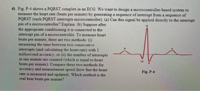 Solved 4) Fig. P-4 shows a PQRST complex in an ECG. We want | Chegg.com