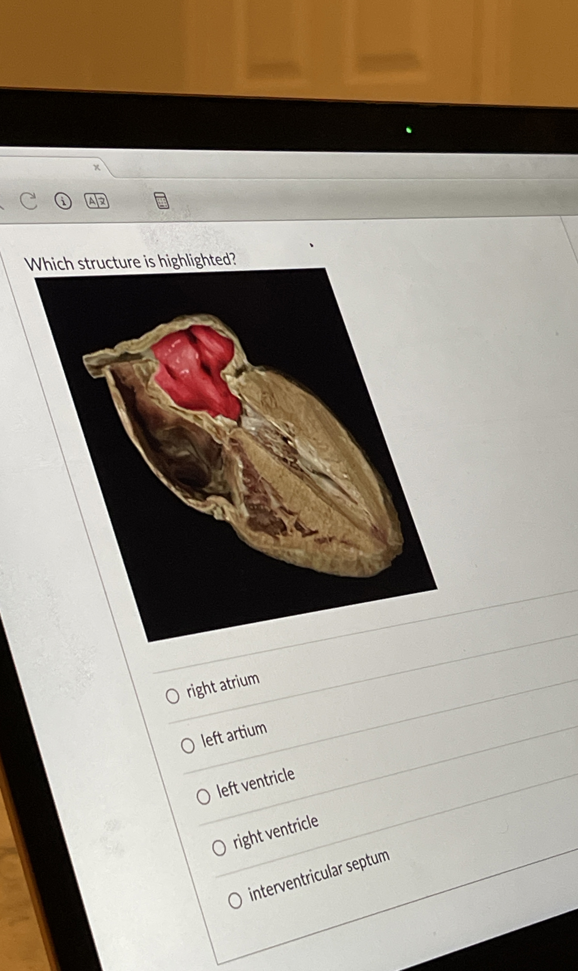 Solved Which structure is highlighted?right | Chegg.com