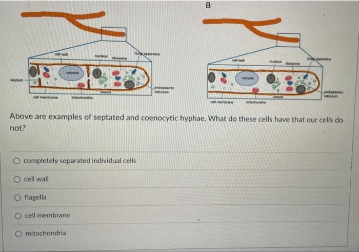Solved Above are examples of septated and coenocytic hyphae. | Chegg.com