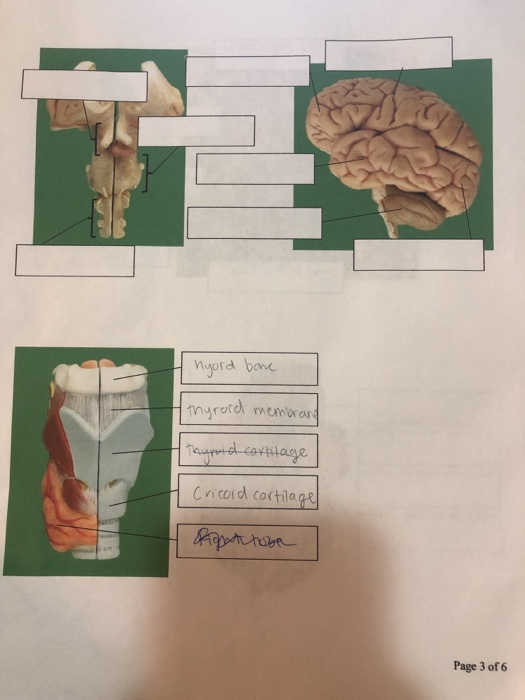 Word Bank Torso Model OAdrenal gland Aorta O Aortic | Chegg.com