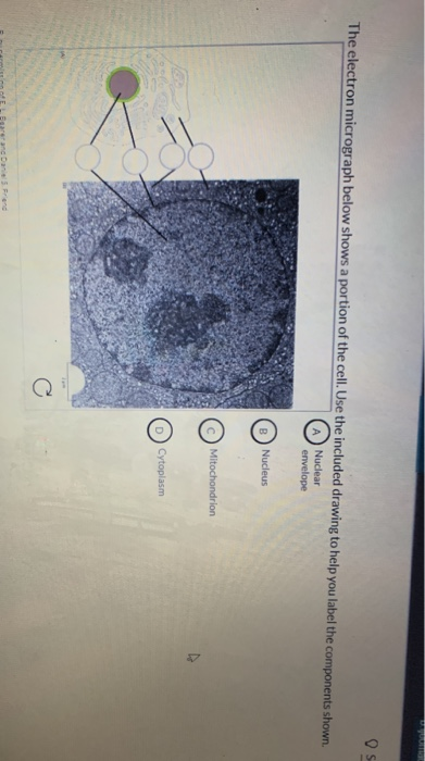 Solved The electron micrograph below shows a portion of the | Chegg.com