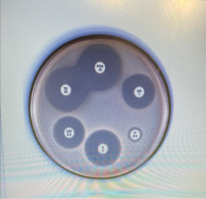 Solved Measure the zones of inhibition on the plate below | Chegg.com