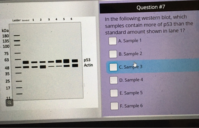 Solved Question #7 2 Ladder 1 6 3 4 5 kDa 180 135 In the | Chegg.com