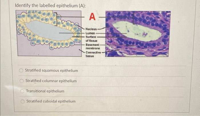 Solved Identify the labelled epithelium (A): Stratified | Chegg.com