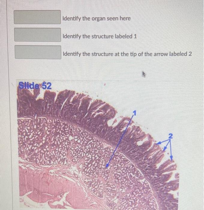 Solved Identify the organ seen here Identify the structure | Chegg.com