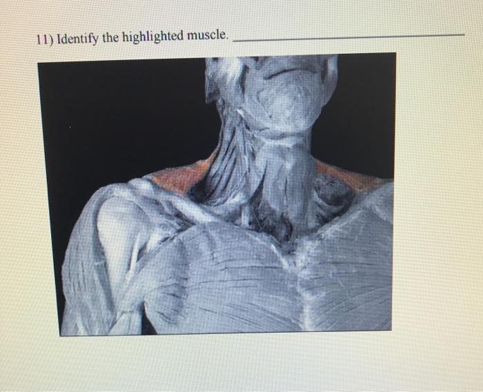 Solved 11) Identify the highlighted muscle. 10) Identify | Chegg.com