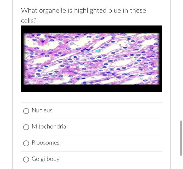 Solved What structure is highlighted in blue? Lumen | Chegg.com