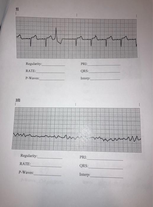 Solved Interpret the following EKG Rhythms. What is the | Chegg.com