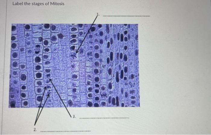 Solved Label the stages of Mitosis | Chegg.com