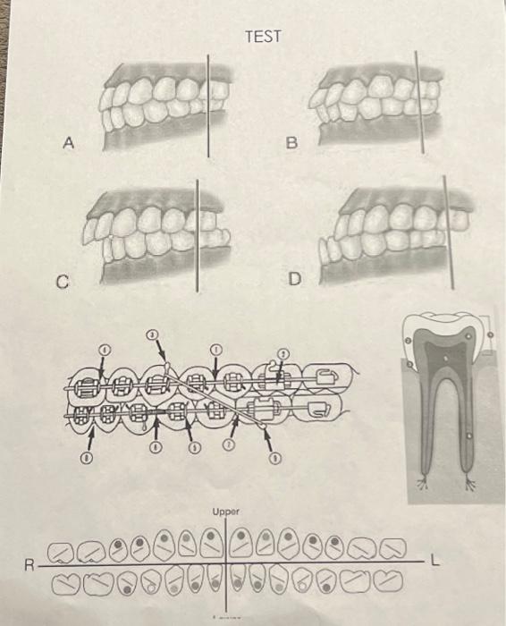 TEST B D | Chegg.com