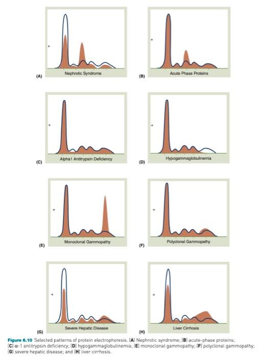 Compare the image of Guillermo’s electropherogram | Chegg.com