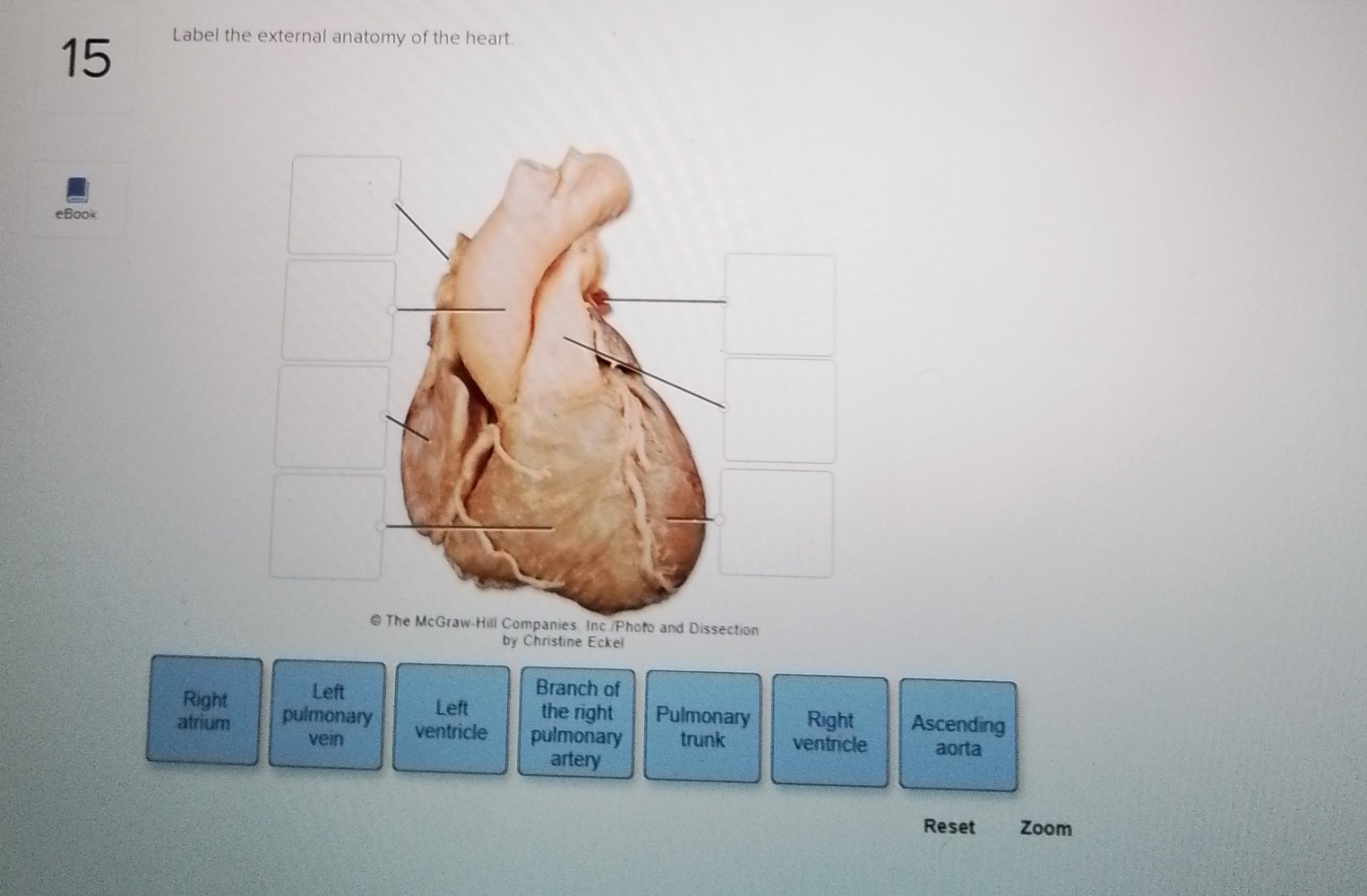 Solved 15Label the external anatomy of the heart.eflooke The | Chegg.com