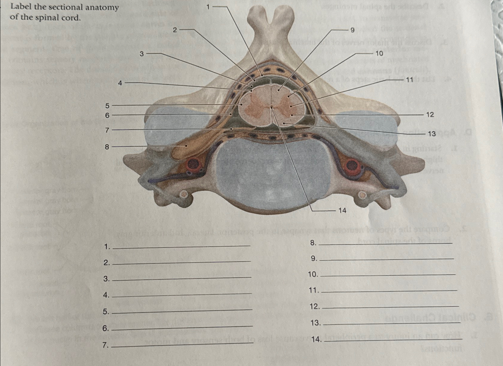 Solved Label the sectional anatomy of the spinal | Chegg.com