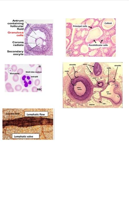 Solved Colloid Principal cells Antrum containing follicular | Chegg.com