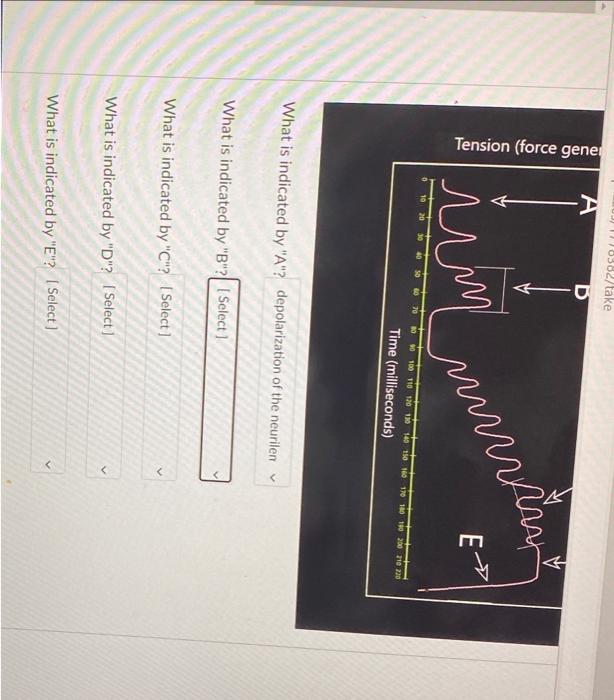 Solved What is indicated by "A"? depolarization of the | Chegg.com