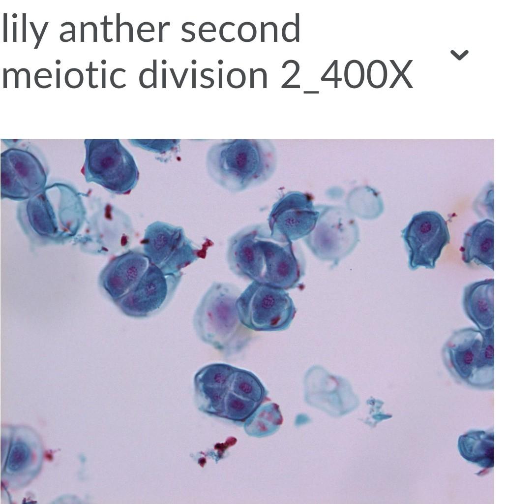 Solved lily ovulary two-nucleate stage_40X
