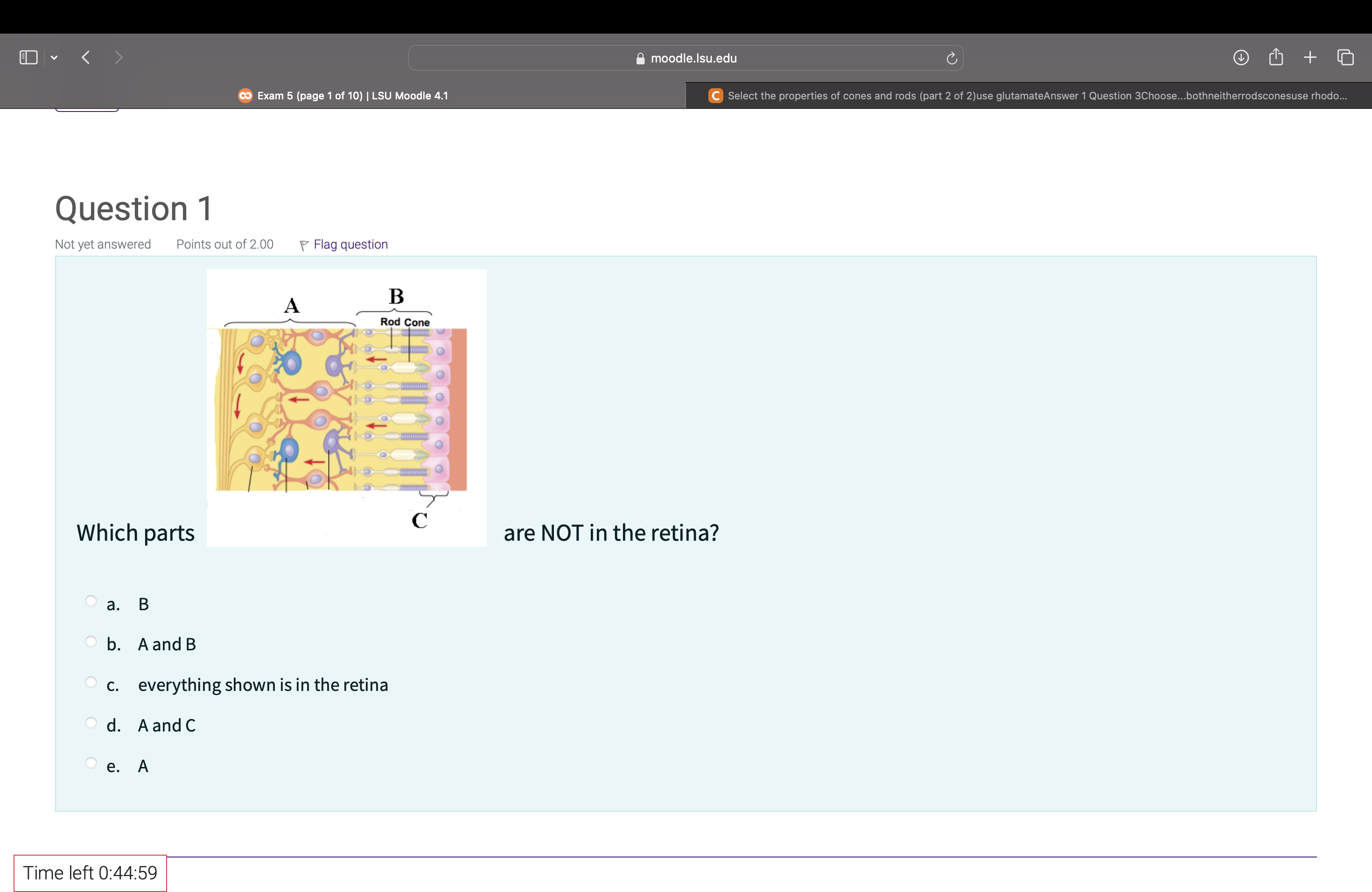 Solved Question 1Which parts are NOT in the retina?a. ﻿Bb. | Chegg.com