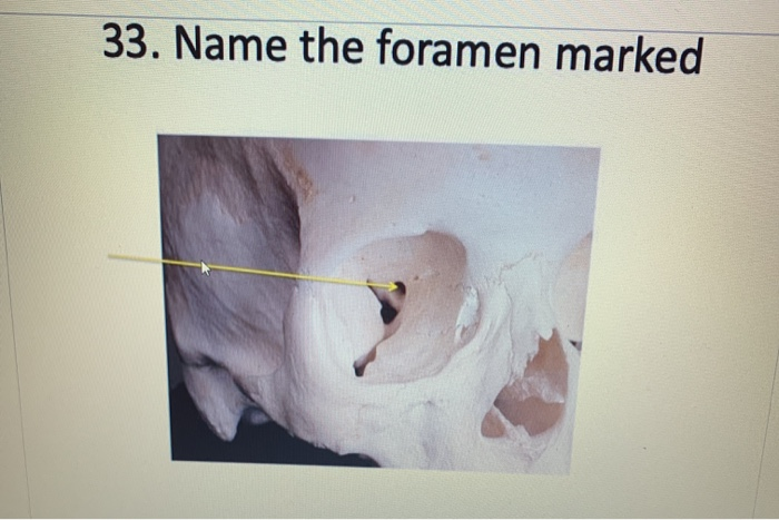 Solved 33. Name the foramen marked | Chegg.com