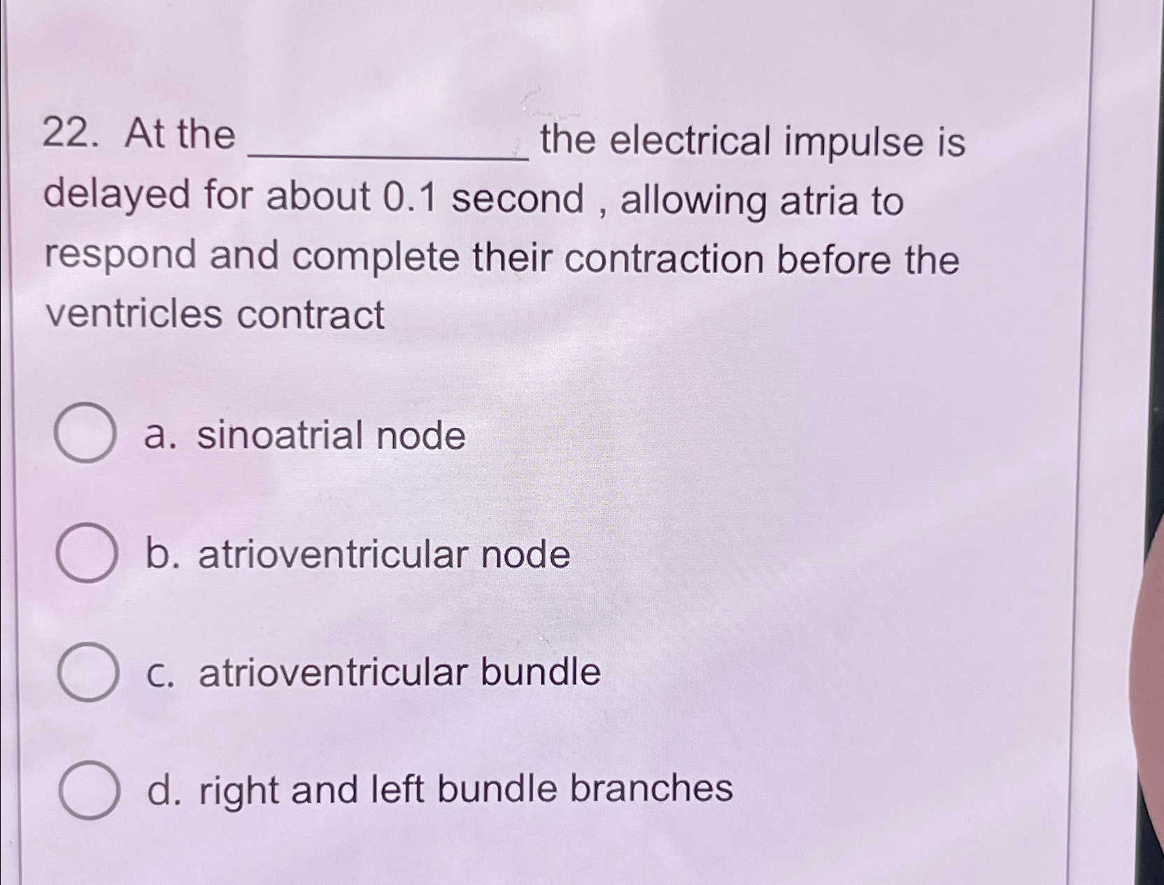 Solved At the the electrical impulse is delayed for about | Chegg.com