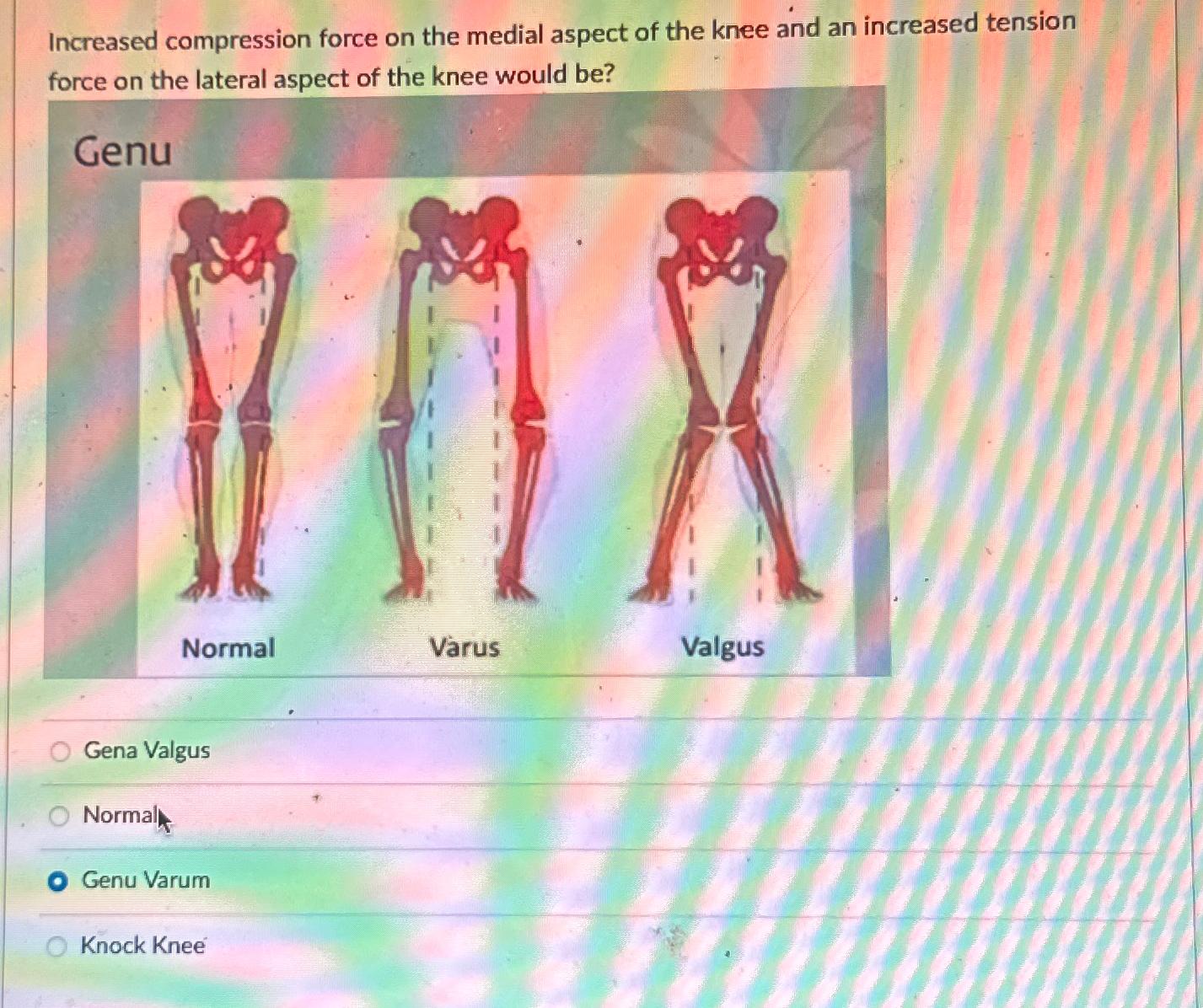 Solved Increased compression force on the medial aspect of | Chegg.com