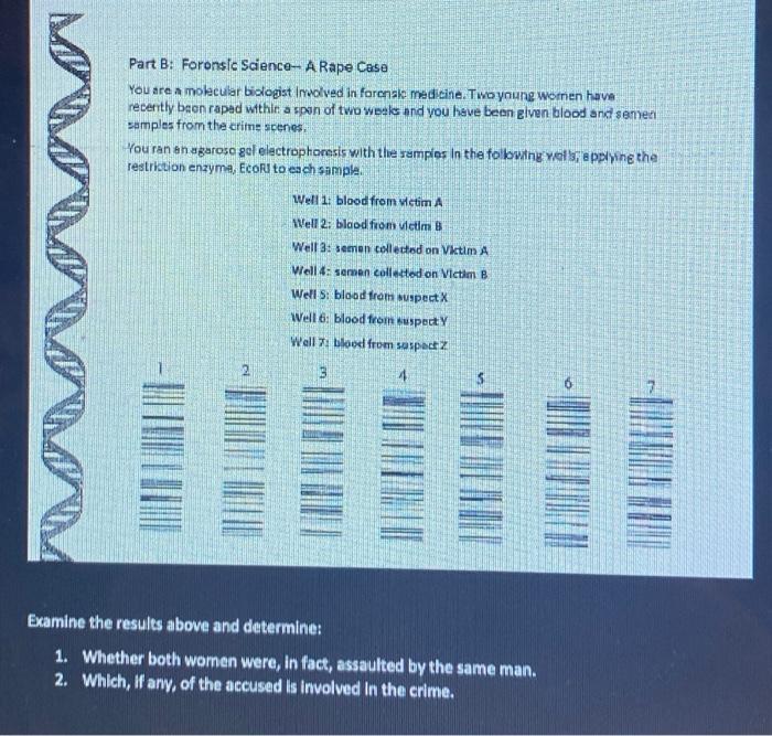 Solved RESTRICTION ENZYME ANALYSIS DNA Fingerprinting | Chegg.com