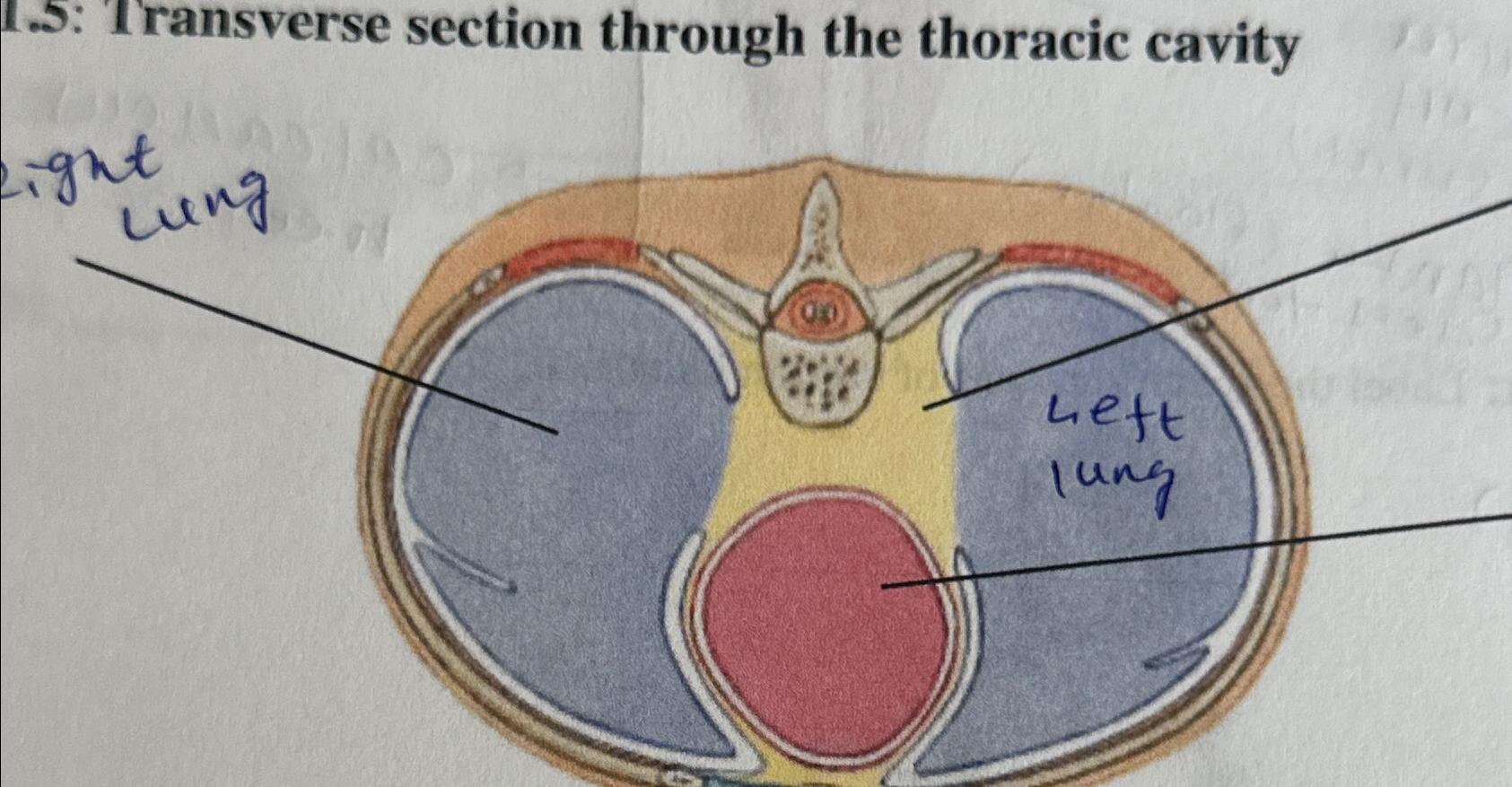 Solved 1.5: Transverse section through the thoracic cavity | Chegg.com