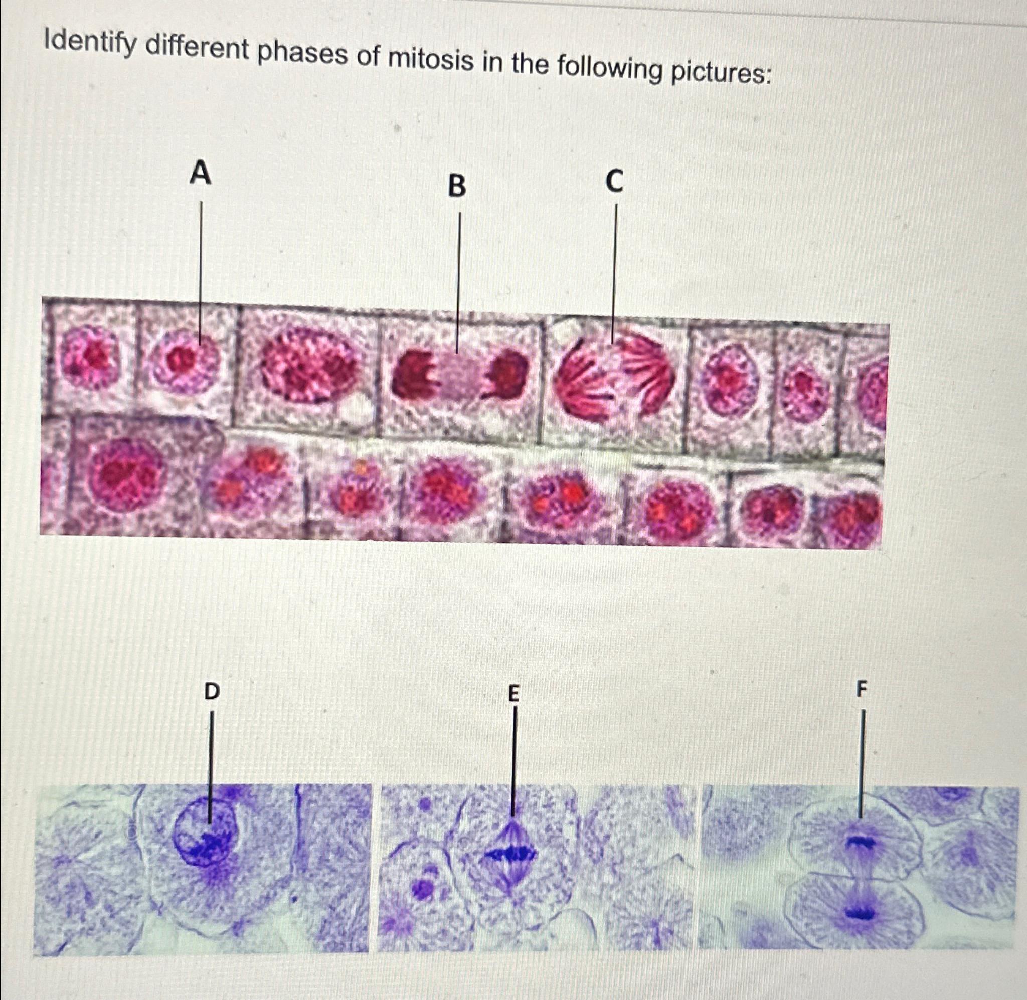 Solved Identify different phases of mitosis in the following | Chegg.com