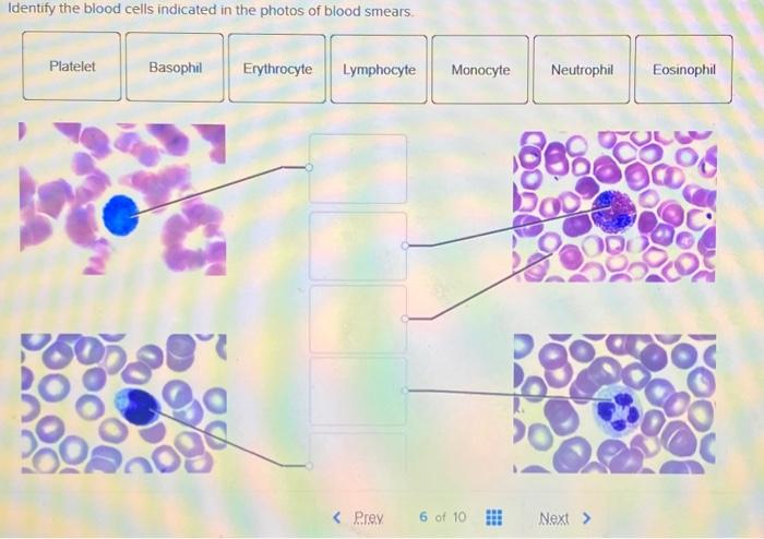Solved Identify the blood cells indicated in the photos of | Chegg.com