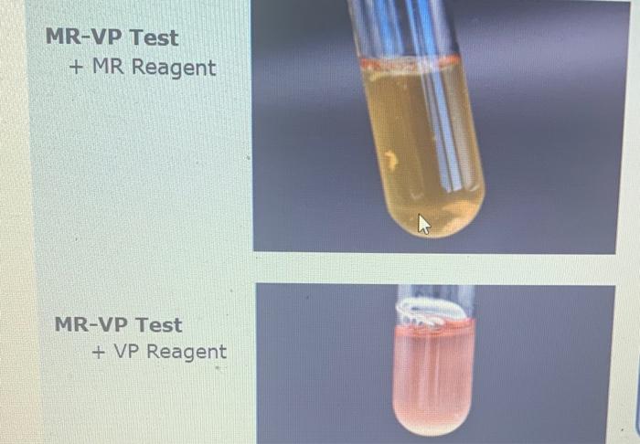 Solved Record your color observations of the MR-VP test. a. | Chegg.com