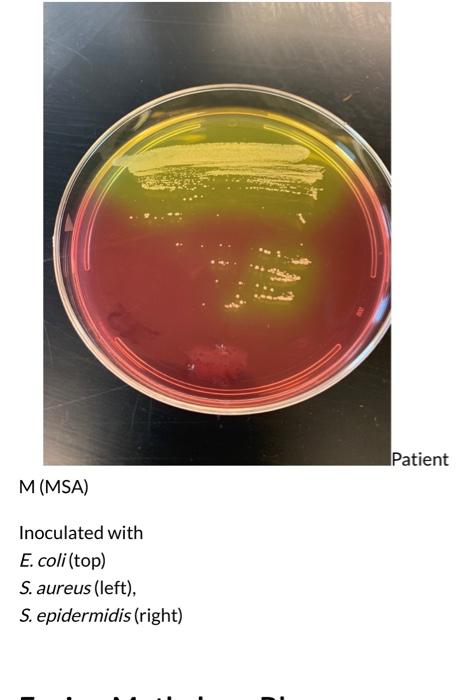 EXERCISE 14: BLOOD AGAR PLATE(BAP) Complete the table | Chegg.com