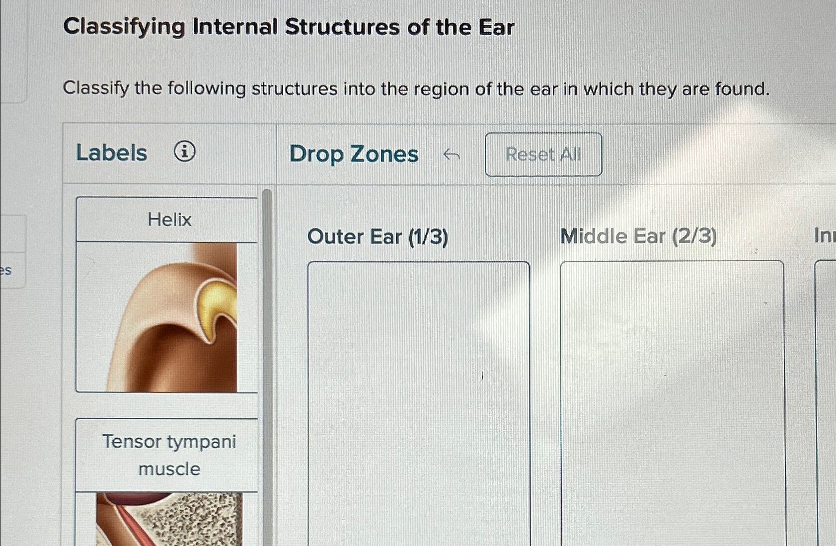 Solved Classifying Internal Structures of the EarClassify | Chegg.com