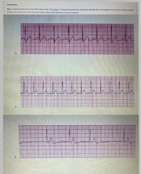 Step 1: Identify each of the three ECG strips and | Chegg.com