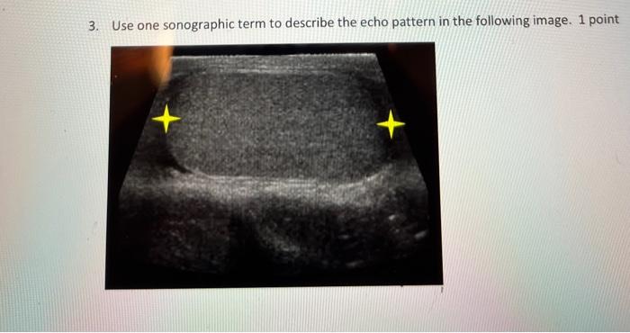 Solved sonography terms: anechoic, complex, echogenic, | Chegg.com