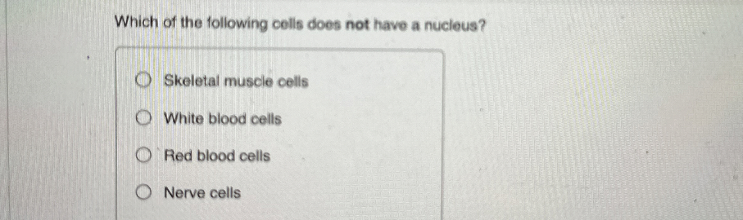 Solved Which of the following cells does not have a | Chegg.com