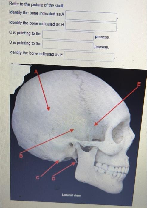 Solved Refer to the picture of the skull. Identify the bone | Chegg.com