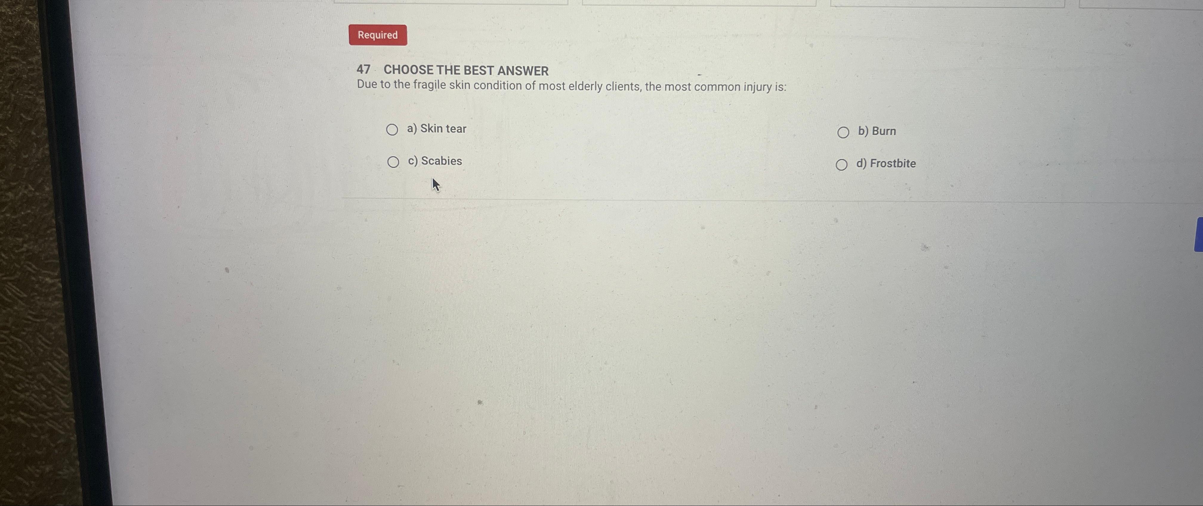 Solved CHOOSE THE BEST ANSWERDue to the fragile skin | Chegg.com