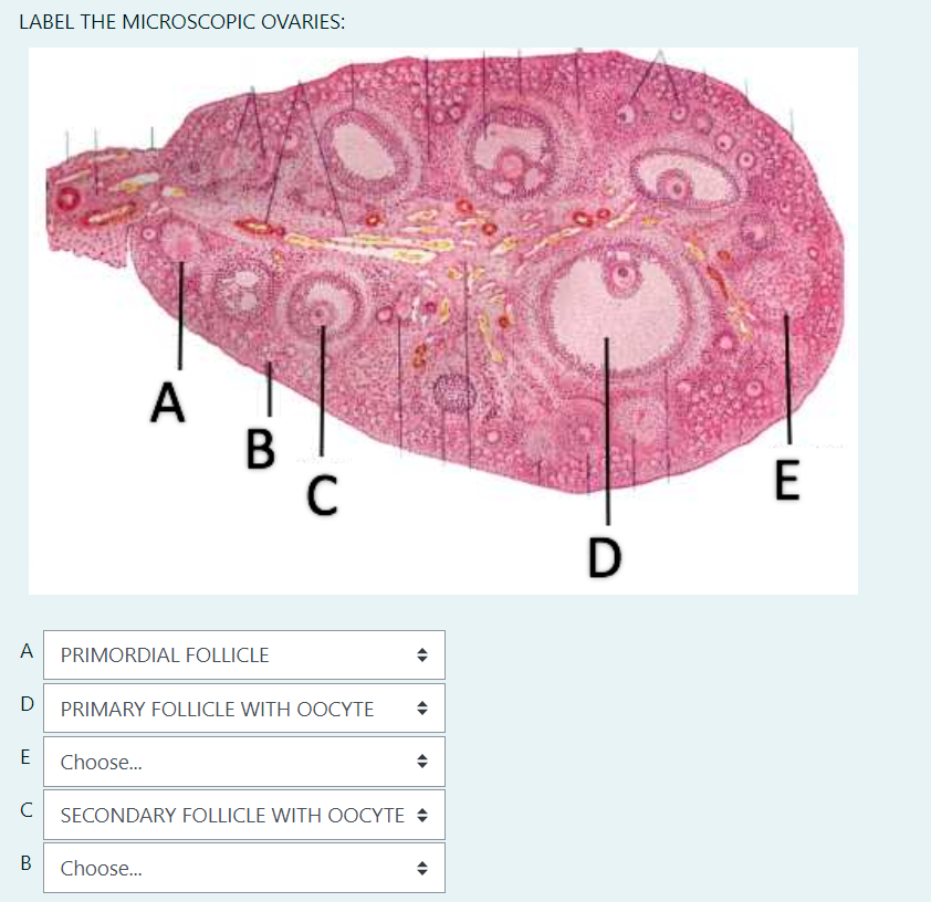 Solved LABEL THE MICROSCOPIC OVARIES:APRIMORDIAL | Chegg.com