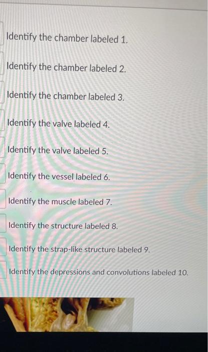 Solved Identify the chamber labeled 1. Identify the chamber | Chegg.com