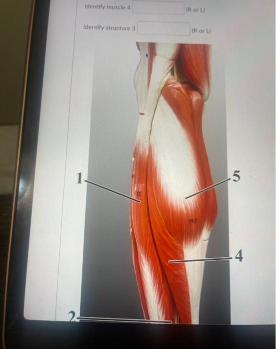 Solved Identify muscle 3 (R or 4) Identify muscle 5 (R or | Chegg.com Solved Identify muscle 3 (R or 4) Identify muscle 5 (R or | Chegg.com