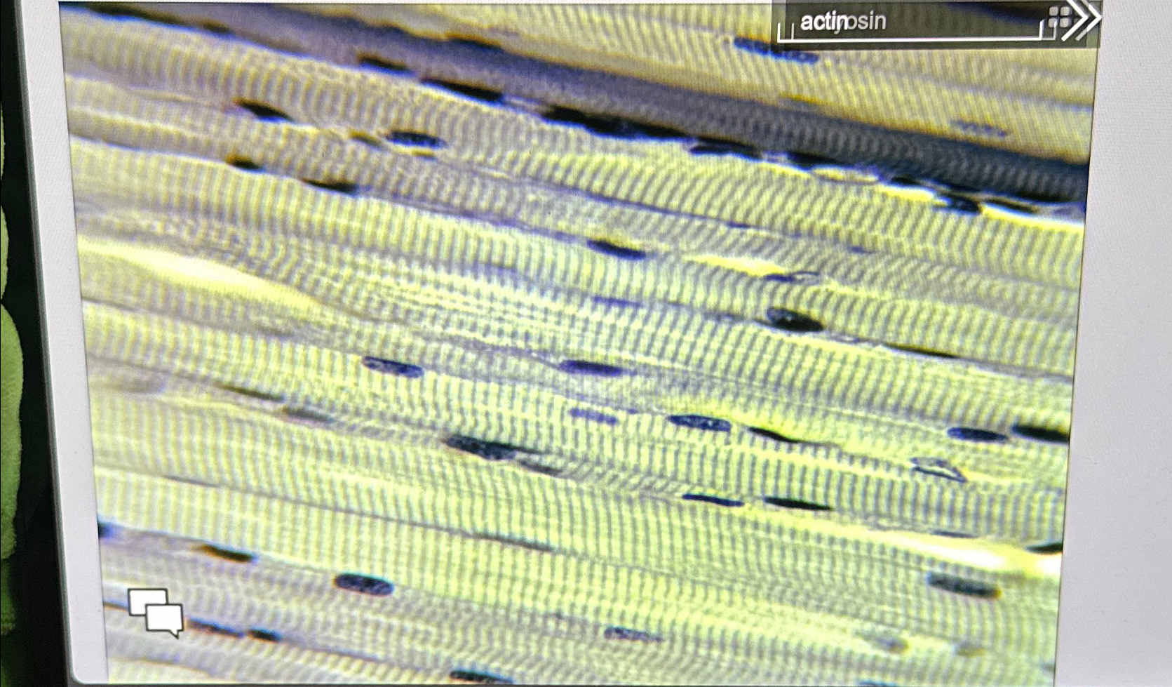 Solved Please label this skeletal muslce actin myosin and | Chegg.com