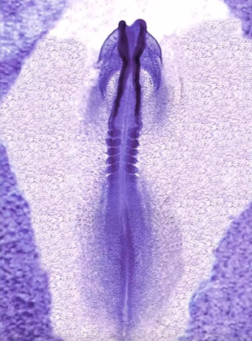 Solved Label the following structures:- ﻿Somites- | Chegg.com