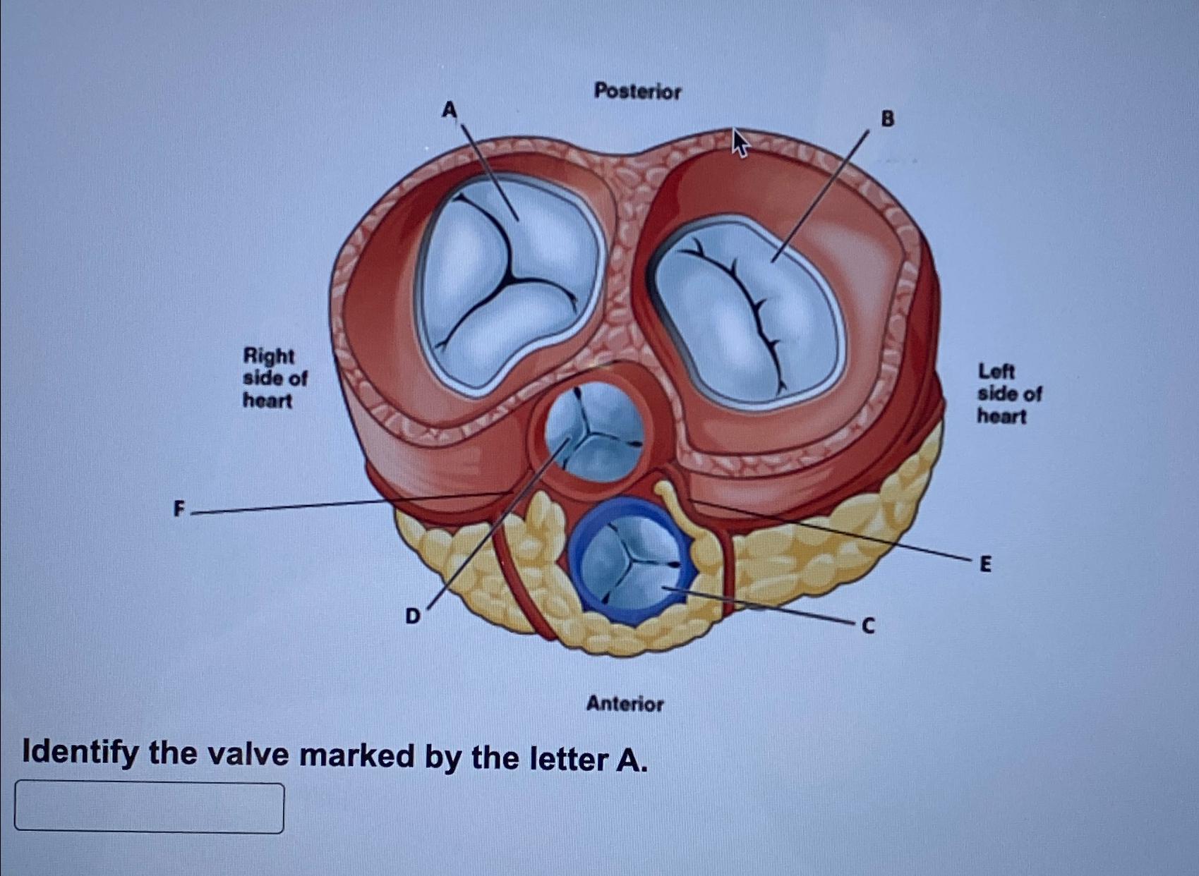 Solved AnteriorIdentify the valve marked by the letter A. | Chegg.com