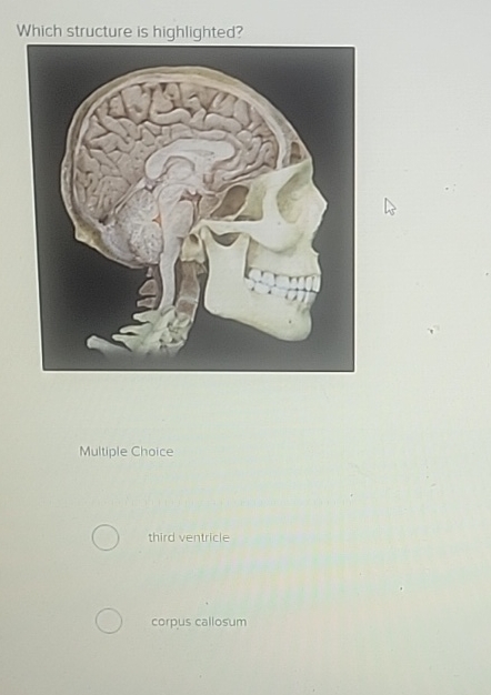 Solved Which structure is highlighted?Multiple Choice | Chegg.com
