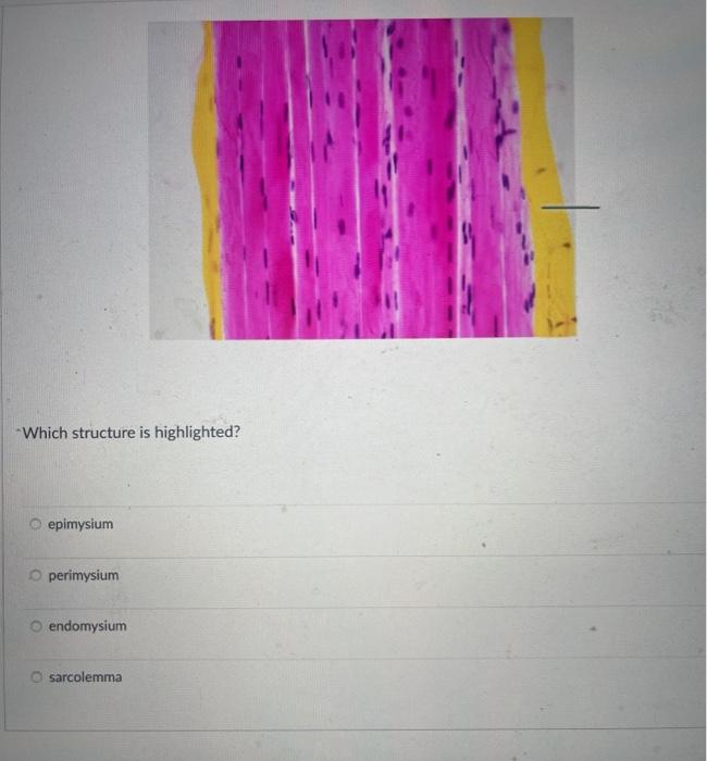 Solved Adjacent cells in this tissue are joined by | Chegg.com