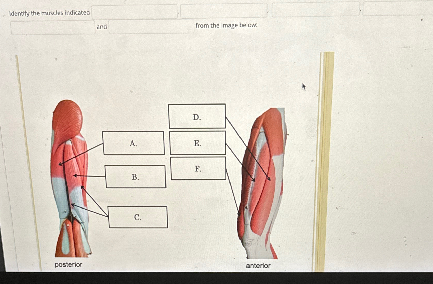 Solved Identify the muscles indicatedand from the image | Chegg.com